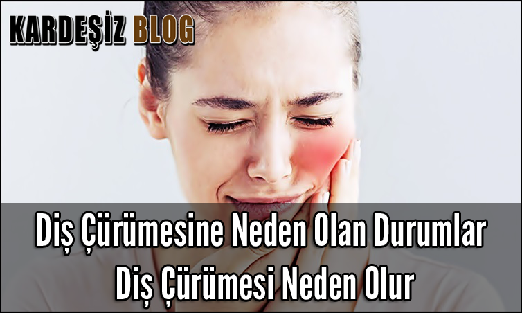 Diş Çürümesine Neden Olan Durumlar Diş Çürümesi Neden Olur