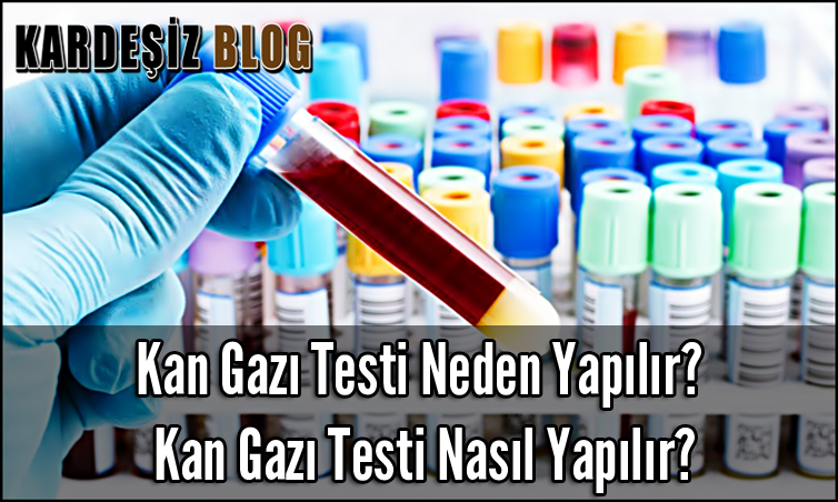 Kan Gazı Testi Neden Yapılır? Kan Gazı Testi Nasıl Yapılır?