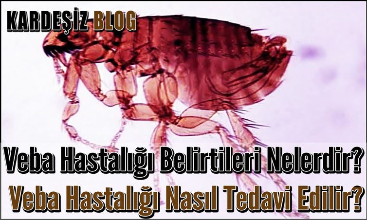 Veba Hastalığı Belirtileri Nelerdir? Veba Hastalığı Nasıl Tedavi Edilir?