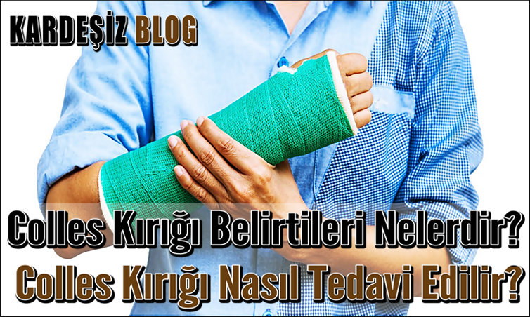 Colles Kırığı Belirtileri Nelerdir? Colles Kırığı Nasıl Tedavi Edilir?