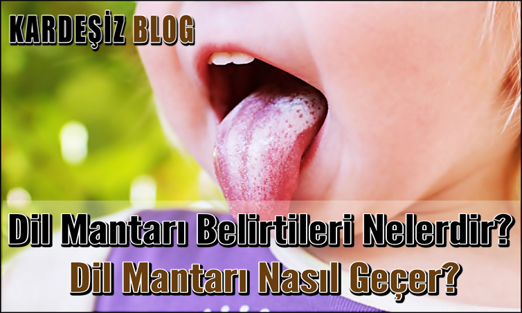 Dil Mantarı Belirtileri Nelerdir? Dil Mantarı Nasıl Geçer?