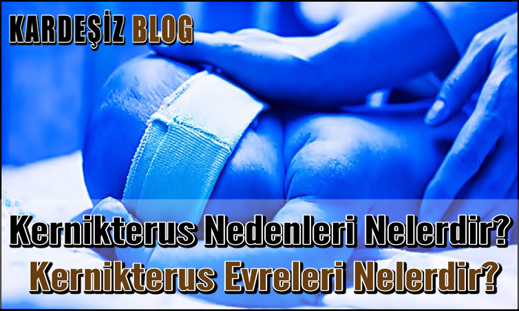 Kernikterus Nedenleri Nelerdir? Kernikterus Evreleri Nelerdir?