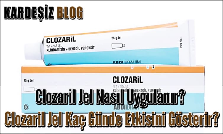 Clozaril Jel Nasıl Uygulanır? Clozaril Jel Kaç Günde Etkisini Gösterir?