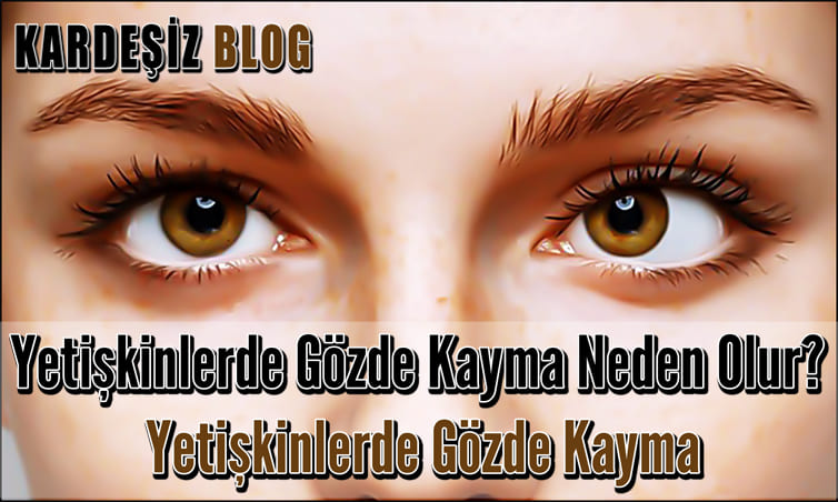 Yetişkinlerde Gözde Kayma Neden Olur? Yetişkinlerde Gözde Kayma